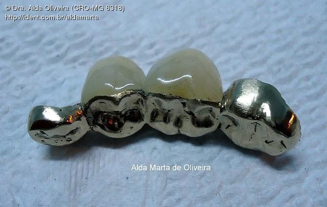 Ppf em Ouro!, Caso clínico | iDent