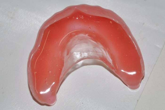 Prótese Total Imediata: Relato de Caso Clínico, Caso clínico | iDent