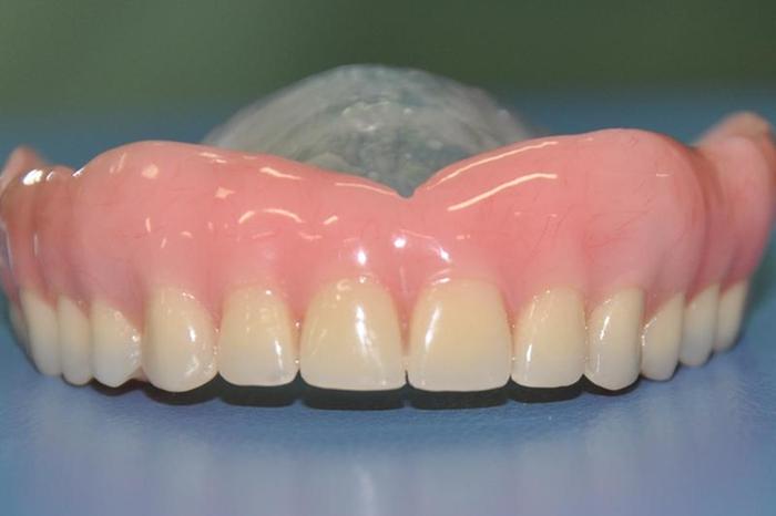 Prótese Total Imediata: Relato de Caso Clínico, Caso clínico | iDent