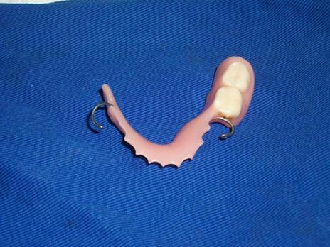 Reabilitação, Caso clínico | iDent