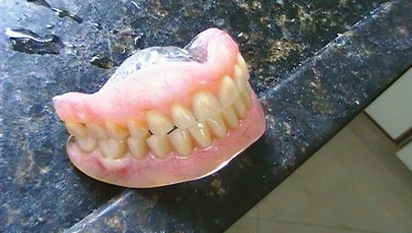 Prótese Total - Superior e Inferior, Caso clínico | iDent
