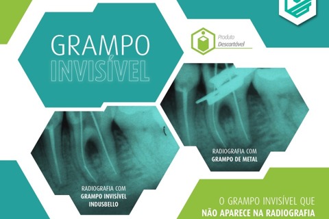Mucocele de Lábio Inferior Induzida por Trauma, Caso clínico | iDent
