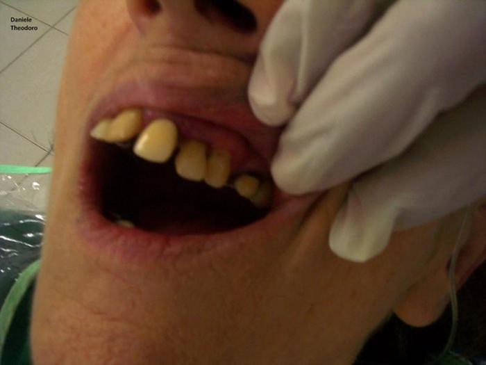 Provisória, Caso clínico | iDent